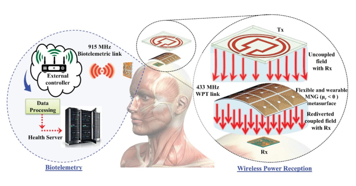 Flexible Metasurface-Coupled Efficient Wireless Power Transfer System for Implantable Devices ...